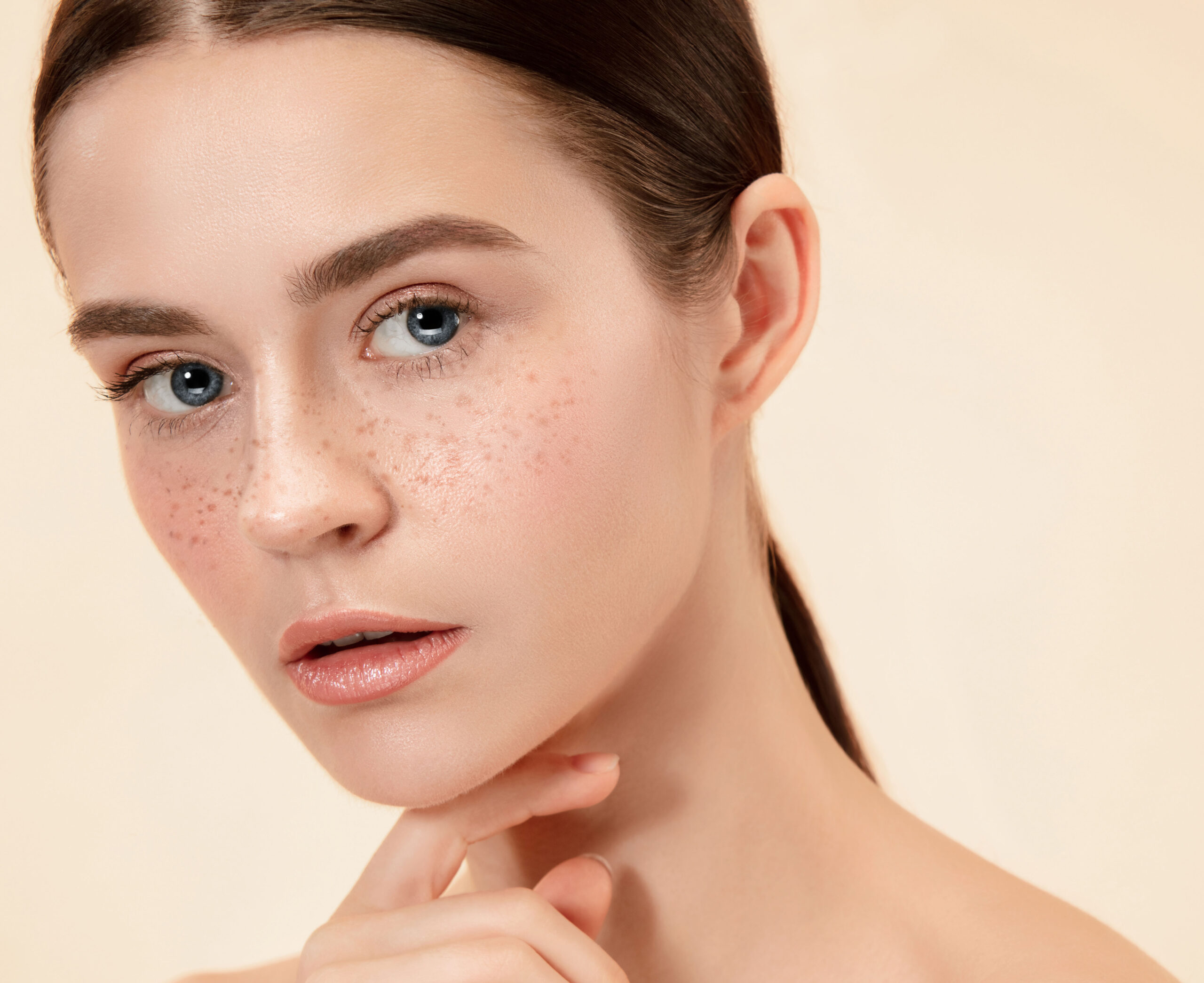 Skin Hyperpigmentation Removal Dubai |Skin Pigmentation Treatment