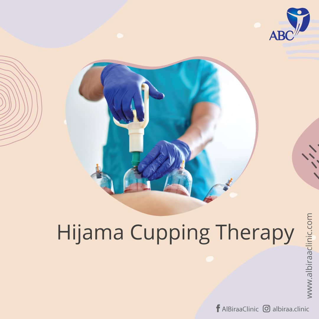 Hijama Cupping Therapy: The Key Benefits of Cupping Therapy