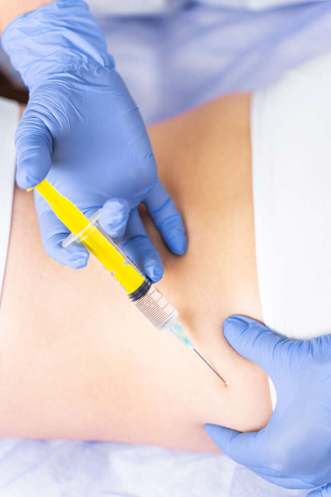 Fat Dissolving Injection | Lipolysis Injection Treatment Dubai